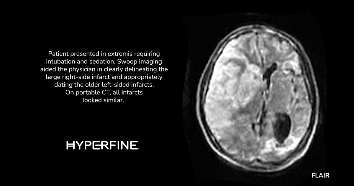 Swoop® Portable MR Imaging™ Additional Clinical Images