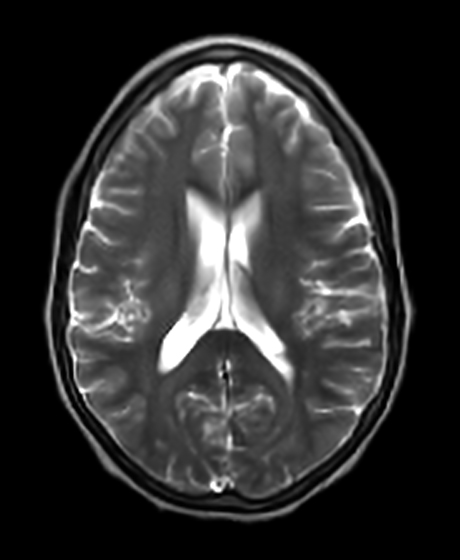 Hyperfine, Inc. and the Swoop® Portable MR Imaging® System